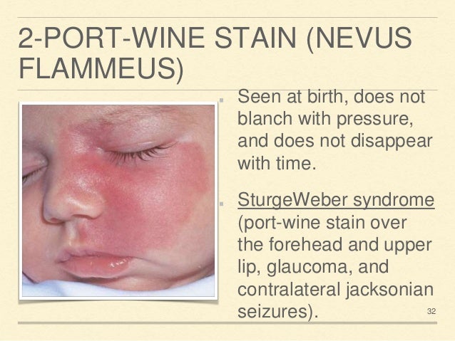Neonatal examination