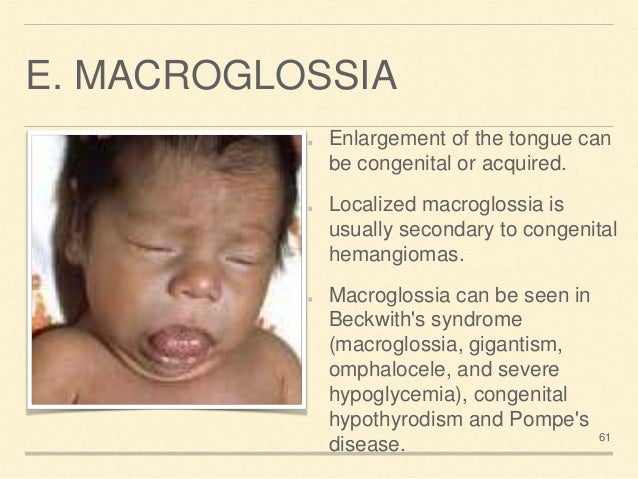 Neonatal examination