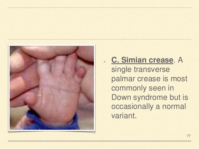 Neonatal examination