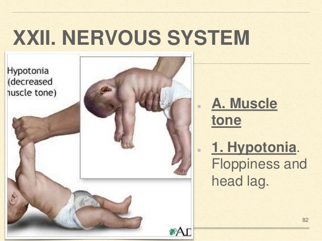 Neonatal examination