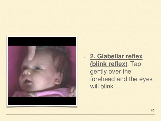 Neonatal examination