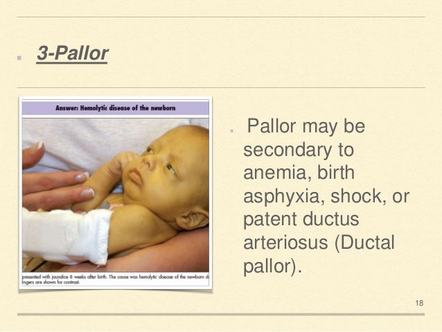 Neonatal 20 examination