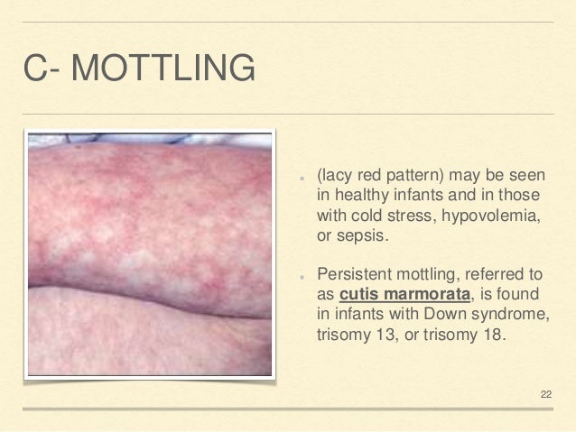 Neonatal 20 examination
