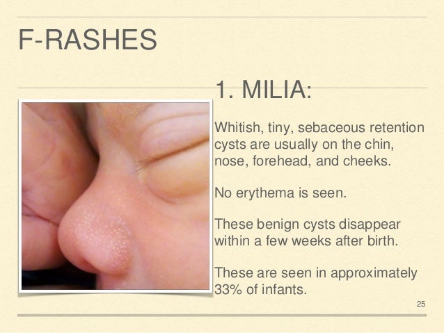 Neonatal 20 examination