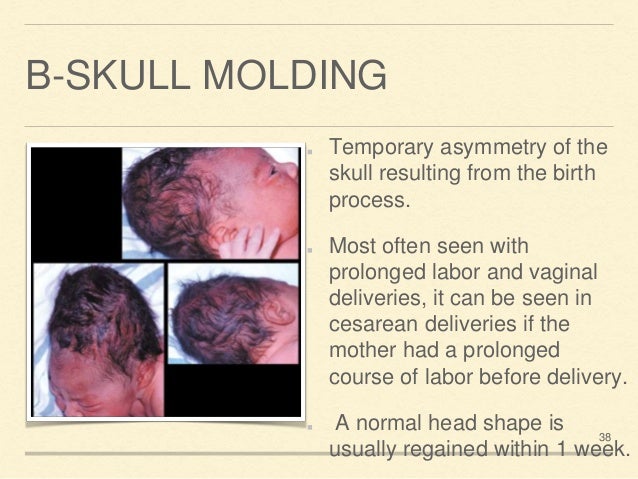 Neonatal 20 examination