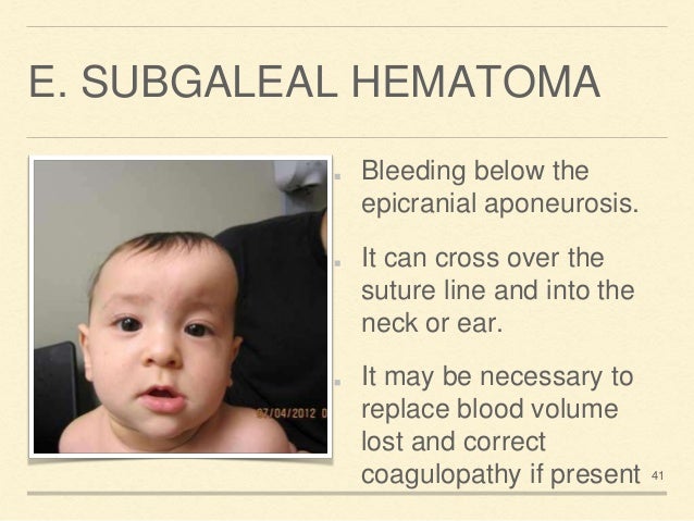 Neonatal 20 examination