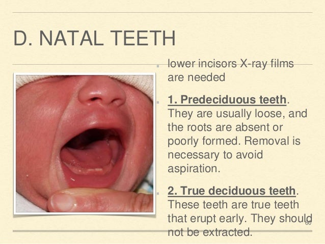 Neonatal 20 examination
