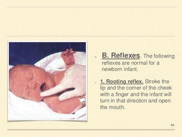 Neonatal 20 examination