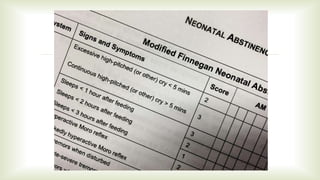 Neonatal abstinence syndrome | PPTX