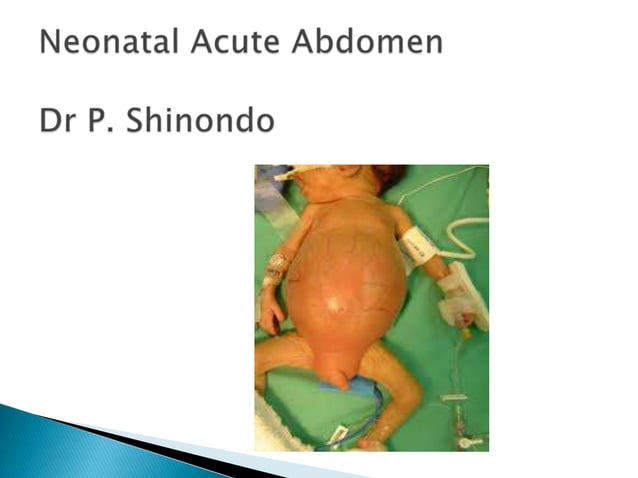 Neonatal acute abdomen. 7th yr | PPT