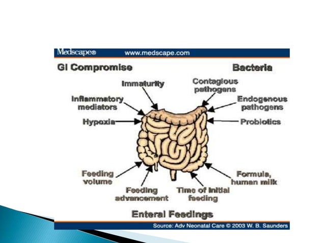 Neonatal acute abdomen. 7th yr | PPT