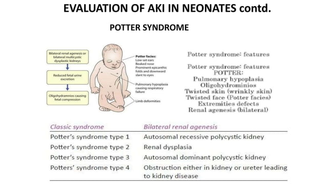 NEONATAL AKI.pptx