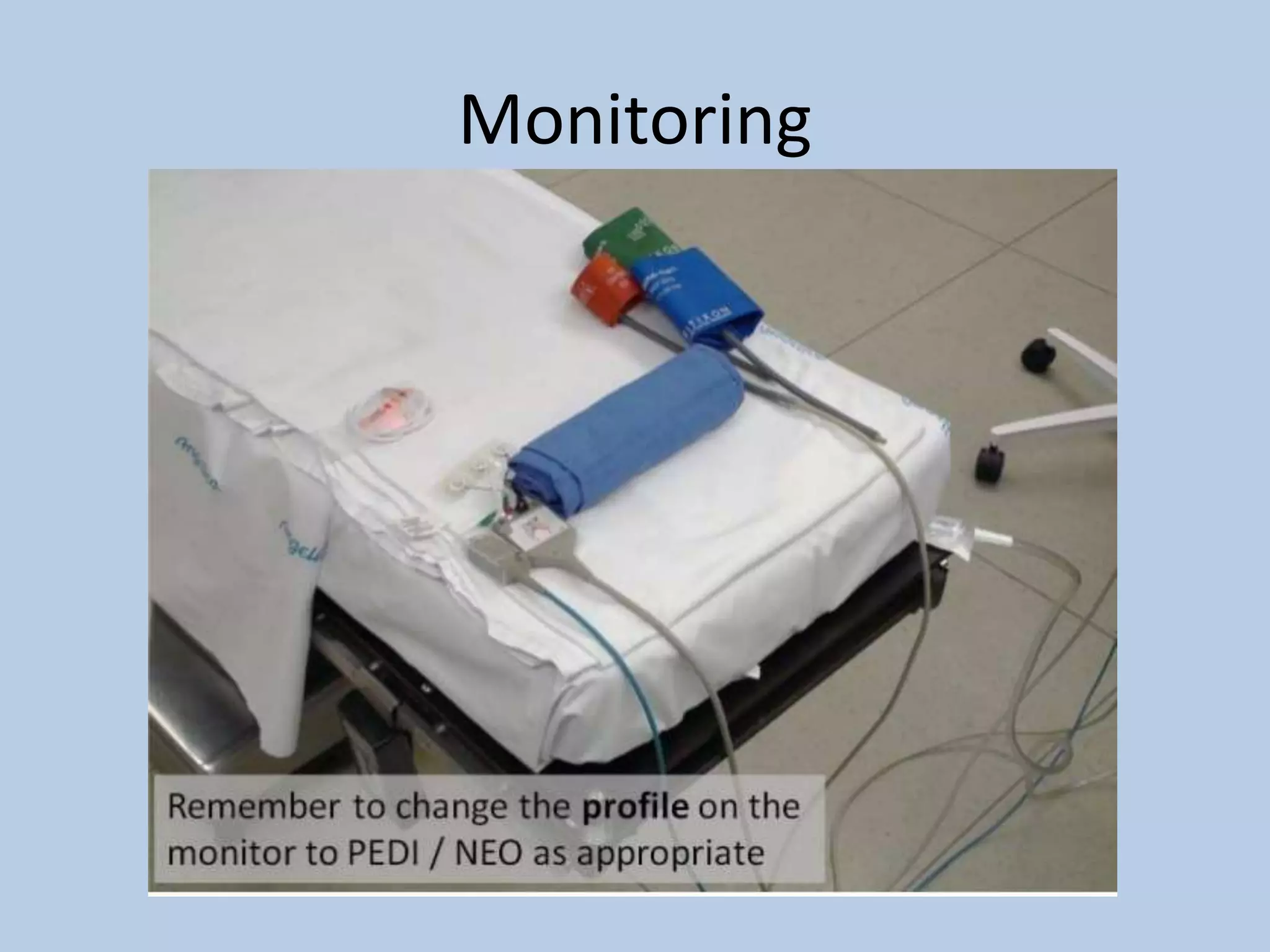 Neonatal and paediatric anaesthesia | PPTX