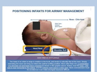 Neonatal and paediatric anaesthesia | PPTX