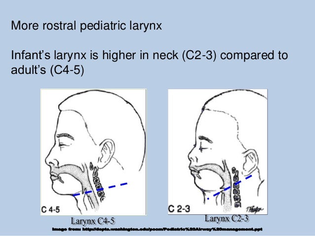 Neonatal and paediatric anaesthesia