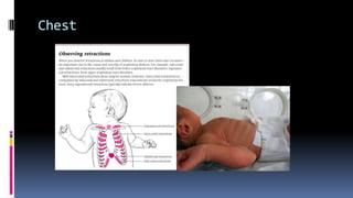 NEONATAL ASSESSMENT-1.pptx