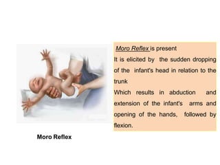 Neonatal assessment | PPTX