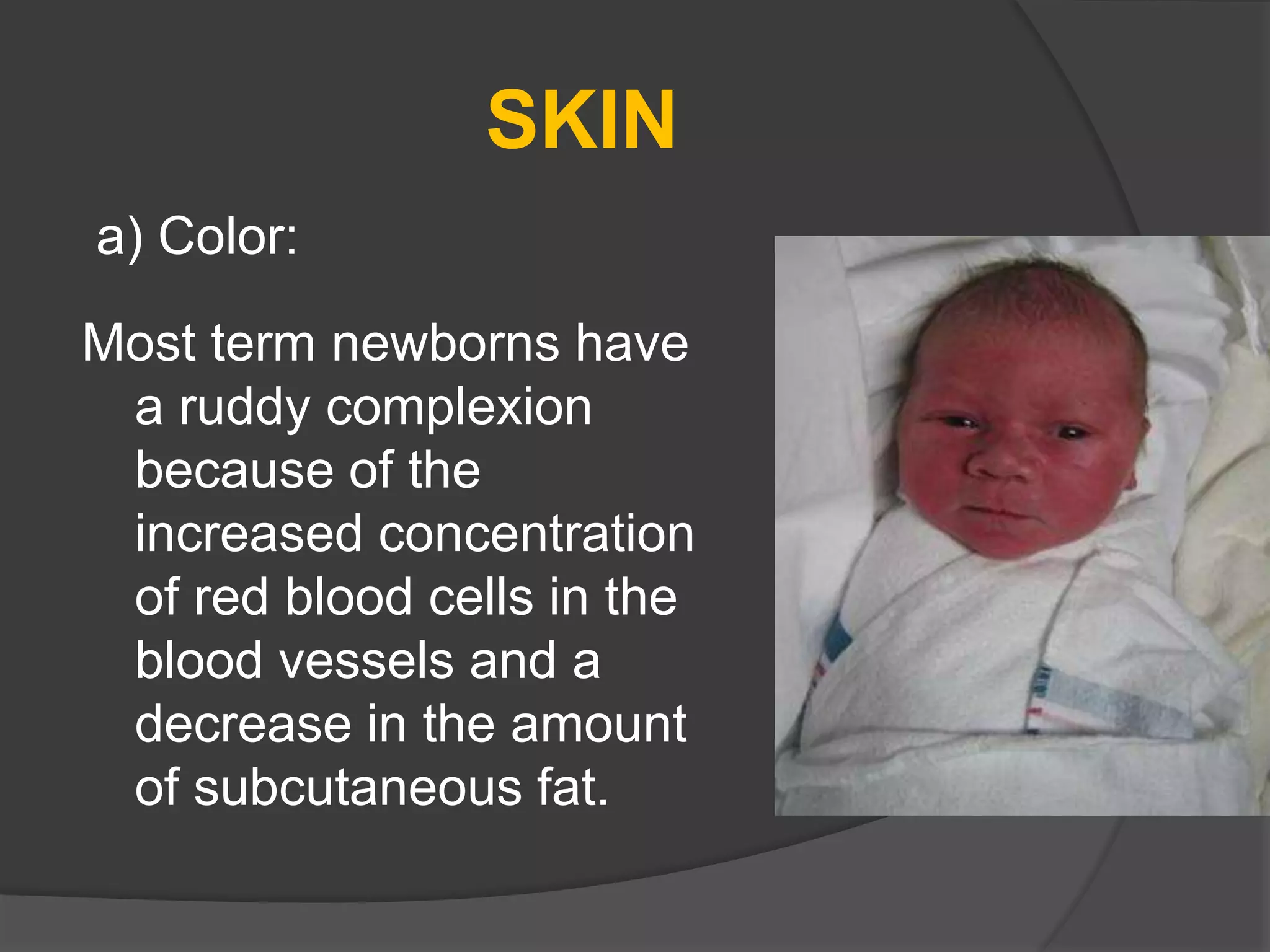 Newborn Assessment | PPTX