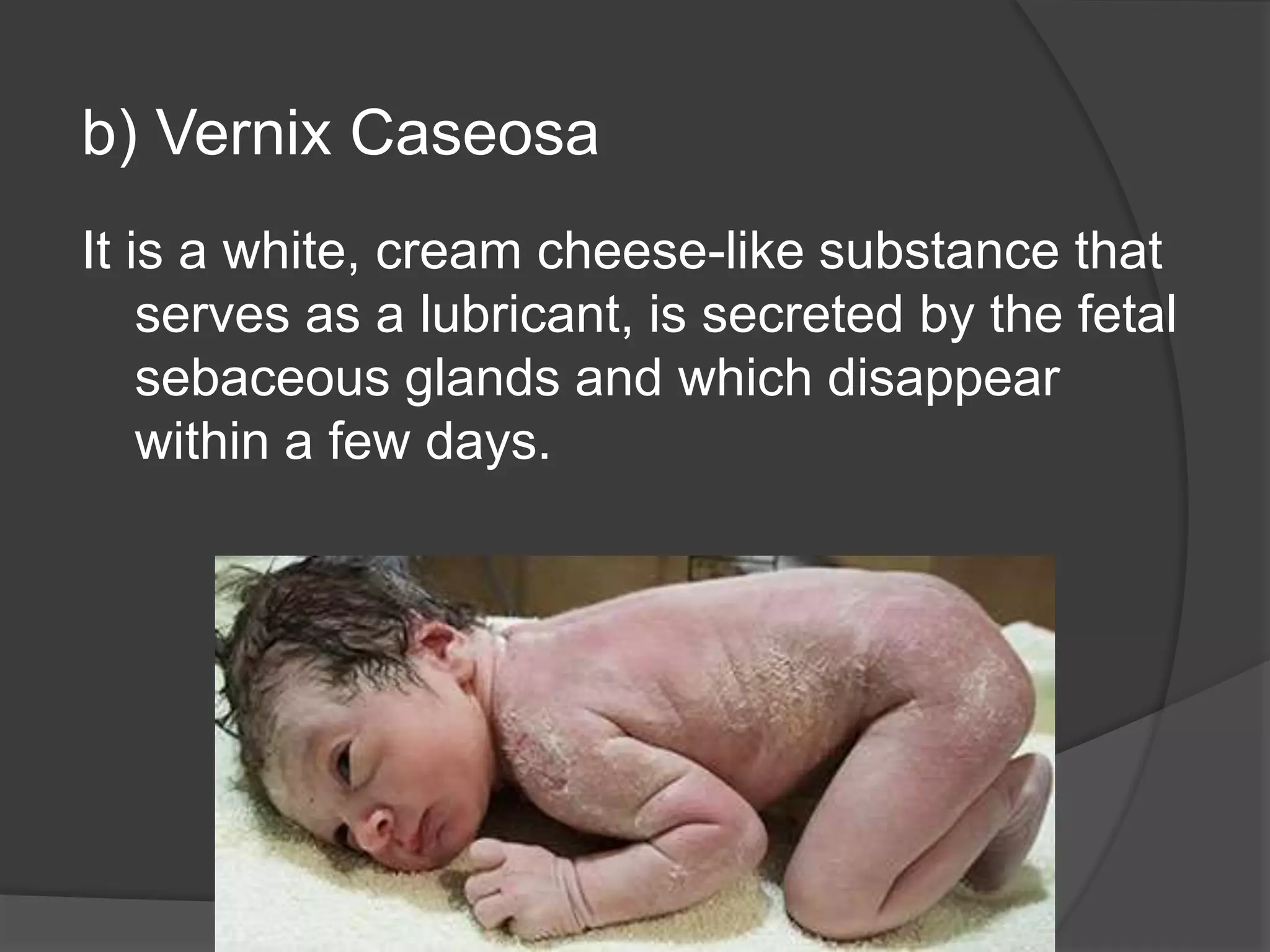 Newborn Assessment | PPTX