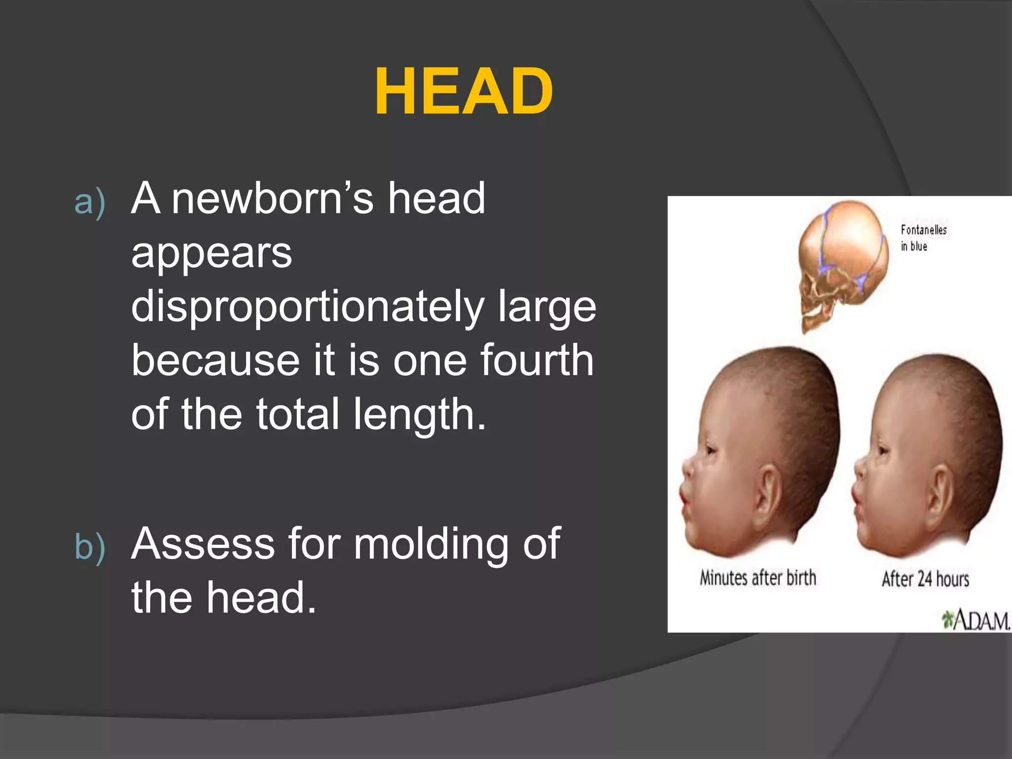 Newborn Assessment | PPTX
