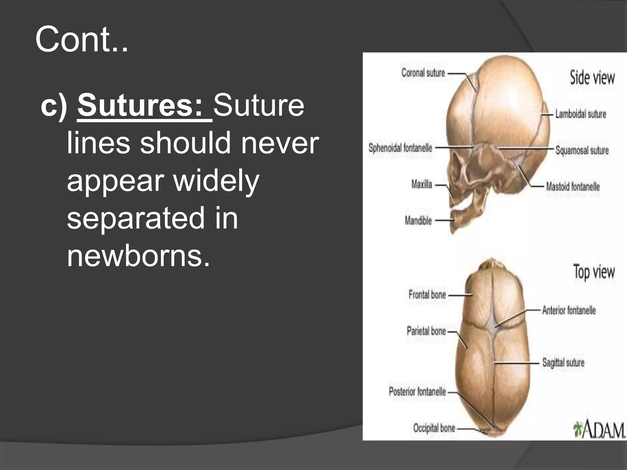 Newborn Assessment | PPTX