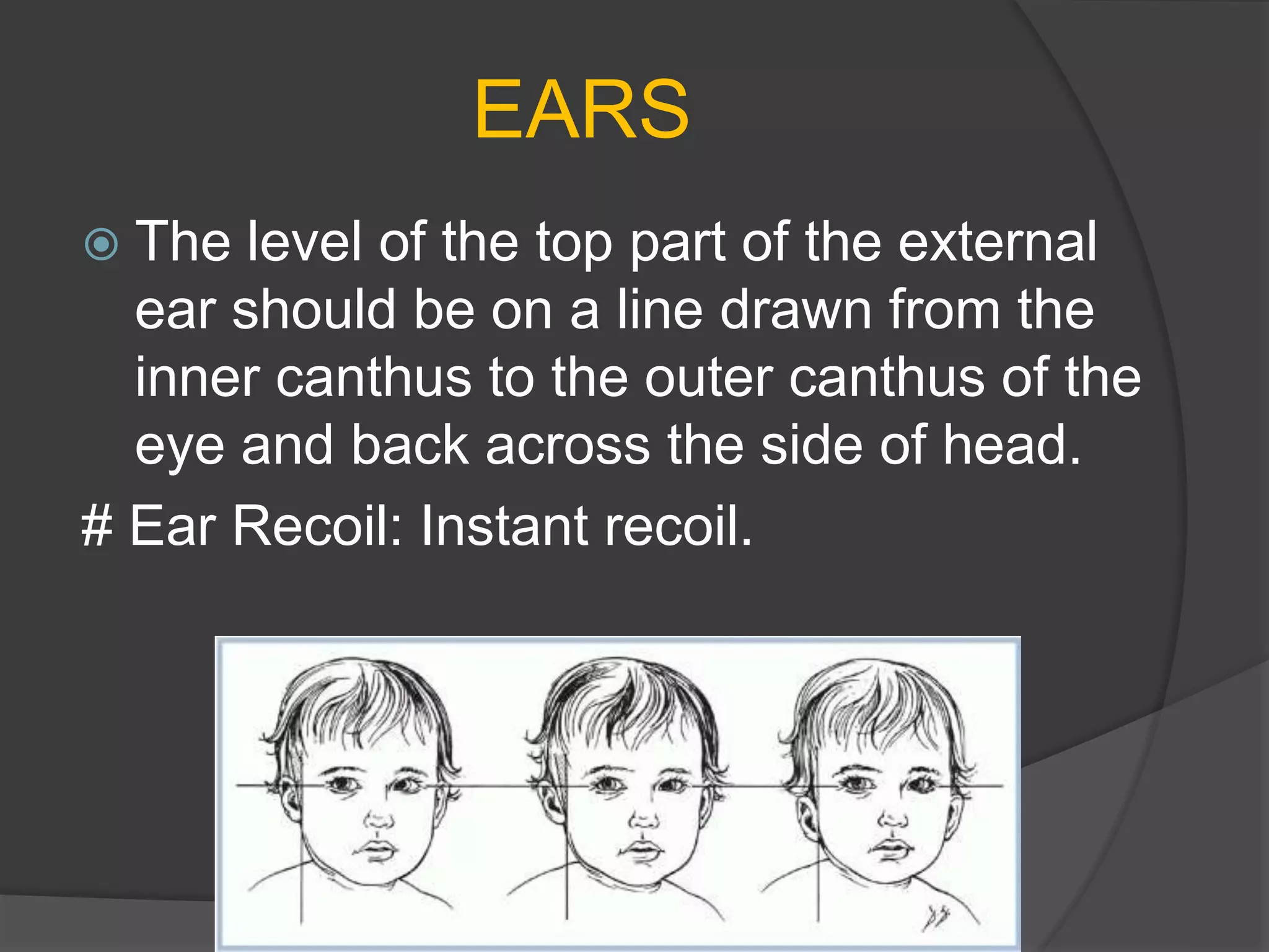 Newborn Assessment | PPTX