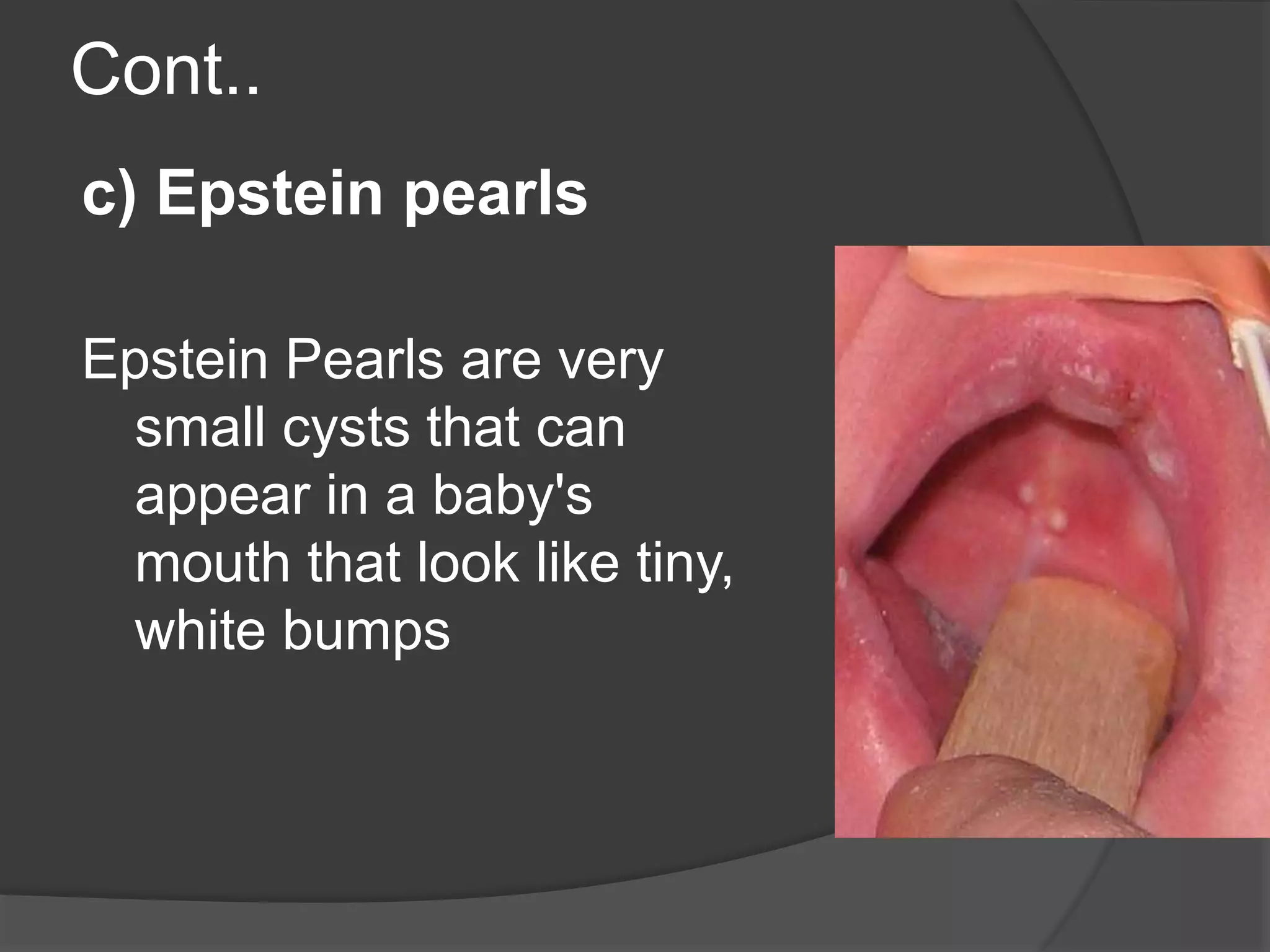 Newborn Assessment | PPTX