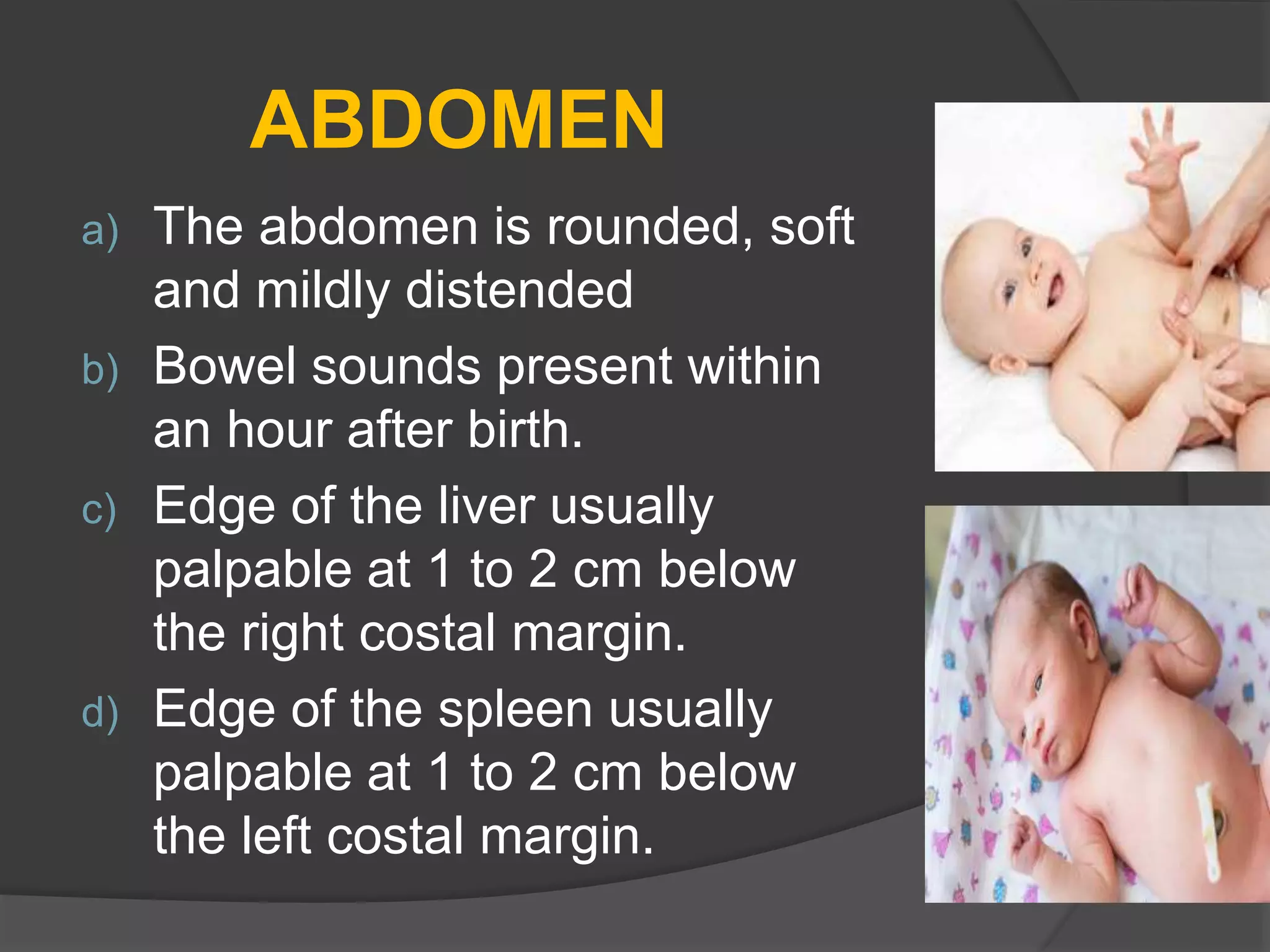 Newborn Assessment | PPTX