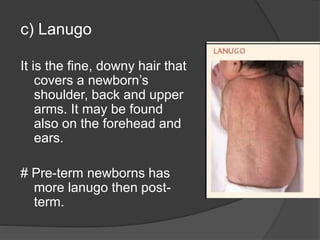 Newborn Assessment | PPT