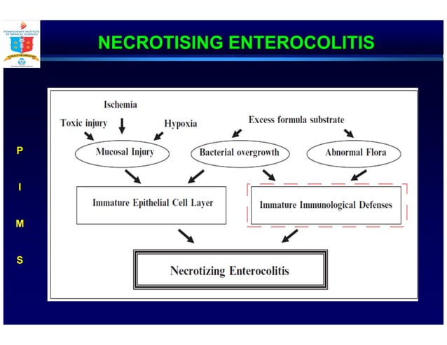 Neonatal biliary emesis- a problem based approach | PPT