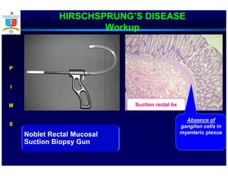 Neonatal biliary emesis- a problem based approach | PDF