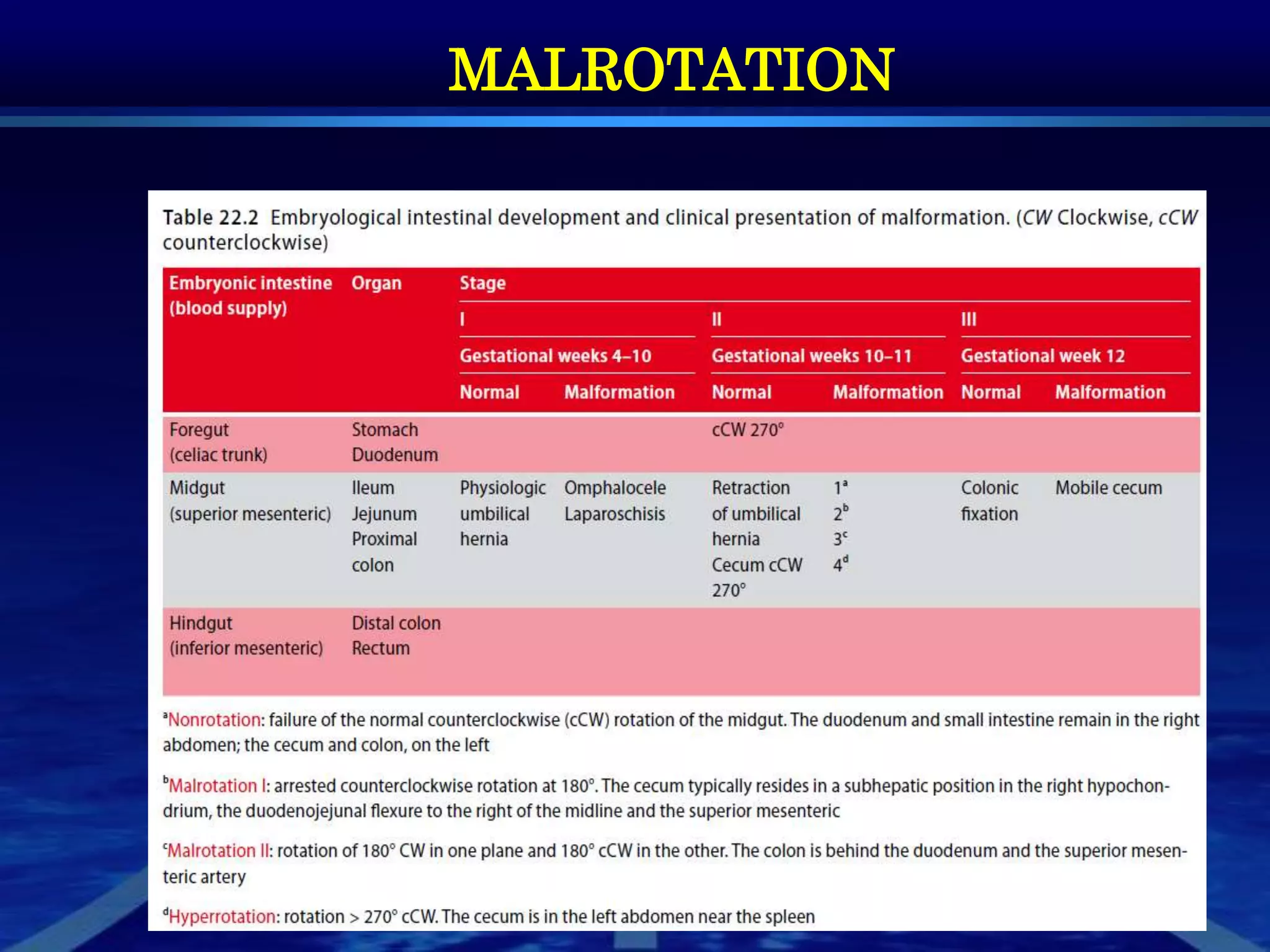 Neonatal Bilious Vomiting- part1 | PPTX