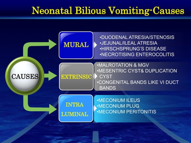 Neonatal Bilious Vomiting- part1 | PPT