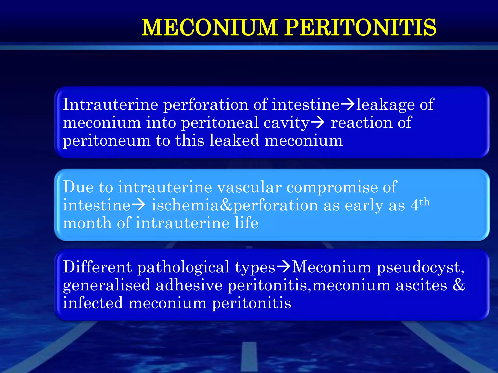 Neonatal Bilious Vomiting- Part2 | PPTX