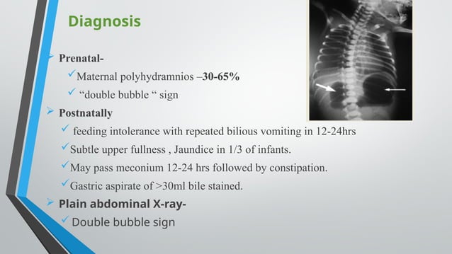 Neonatal Bilious Vomiting in neonatal period | PPTX | Pregnancy ...