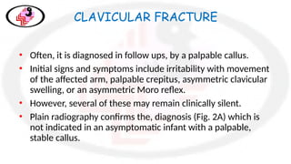 NEONATAL BIRTH FRACTURES - DESCRIBES THE FRACTURES OCCURRING DURING ...