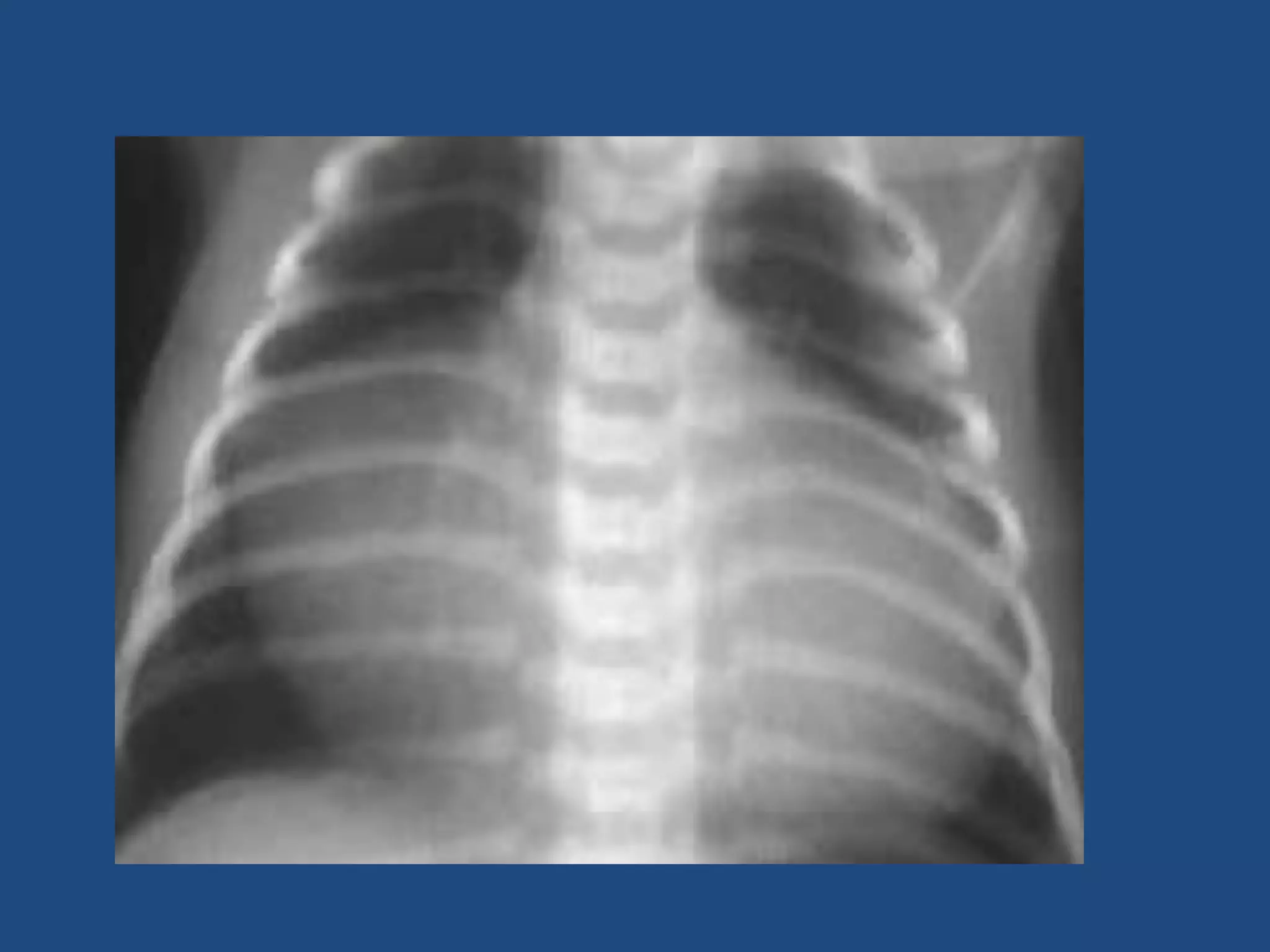 Neonatal cardiac emergency | PPTX | Heart and Cardiovascular Diseases ...