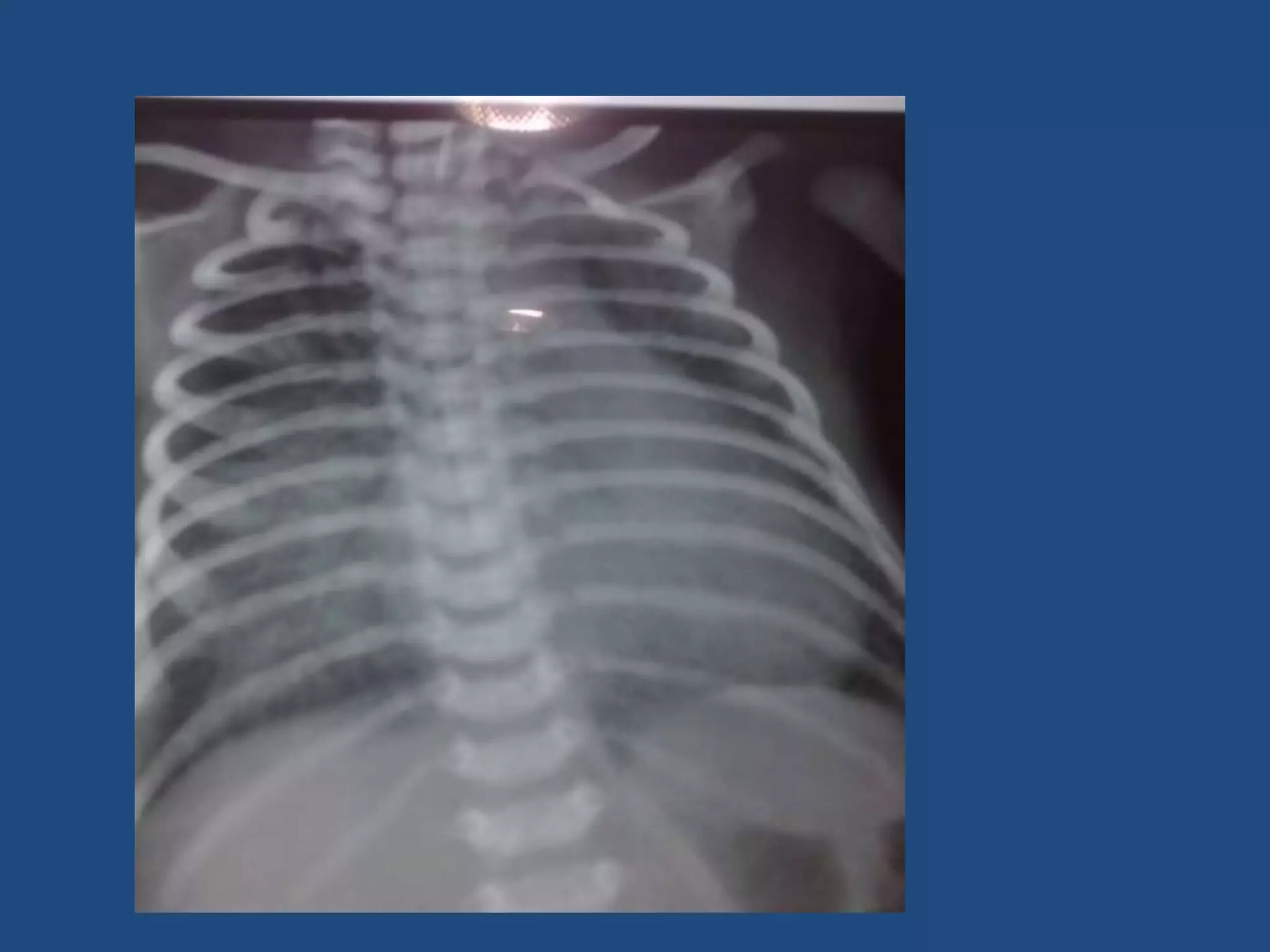Neonatal cardiac emergency | PPTX