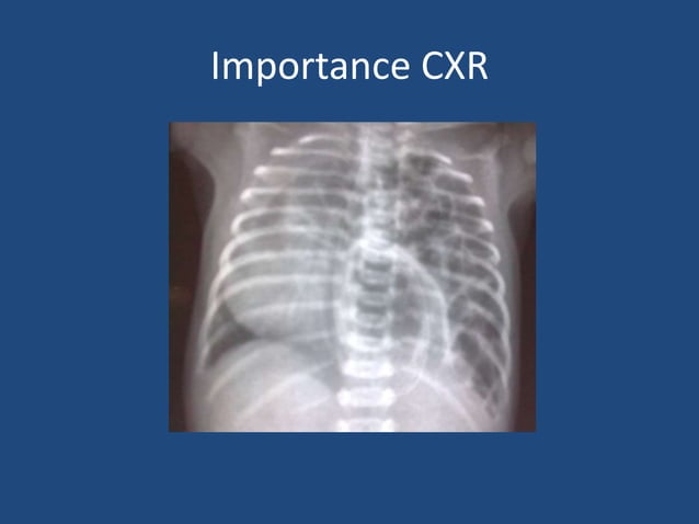 Neonatal cardiac emergency | PPTX | Heart and Cardiovascular Diseases ...