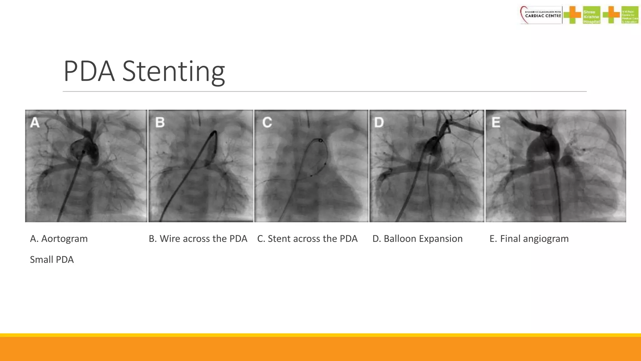 Neonatal cardiac emergency | PPTX