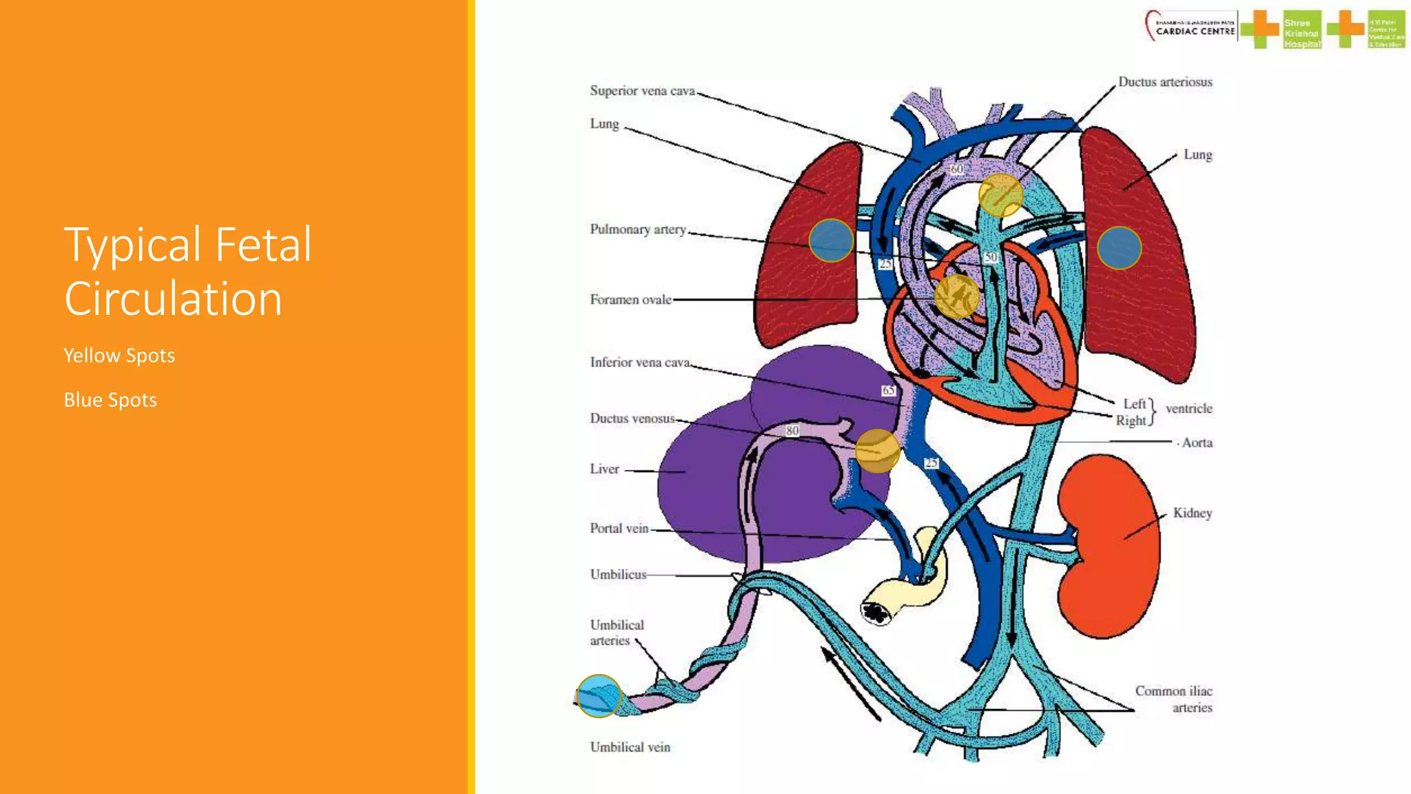 Neonatal cardiac emergency | PPTX