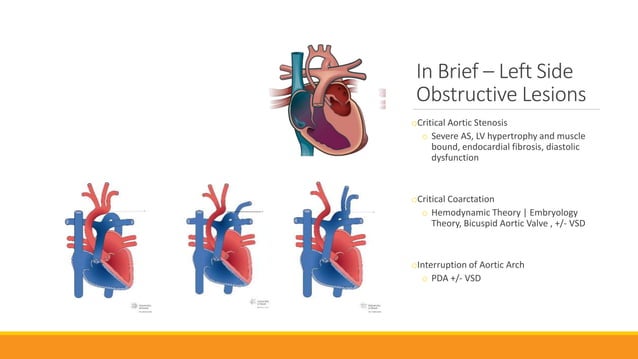 Neonatal cardiac emergency | PPTX | Heart and Cardiovascular Diseases ...