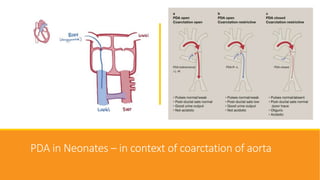 Neonatal cardiac emergency | PPTX | Heart and Cardiovascular Diseases ...