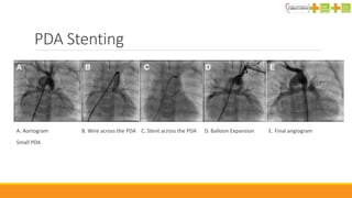 Neonatal cardiac emergency | PPTX