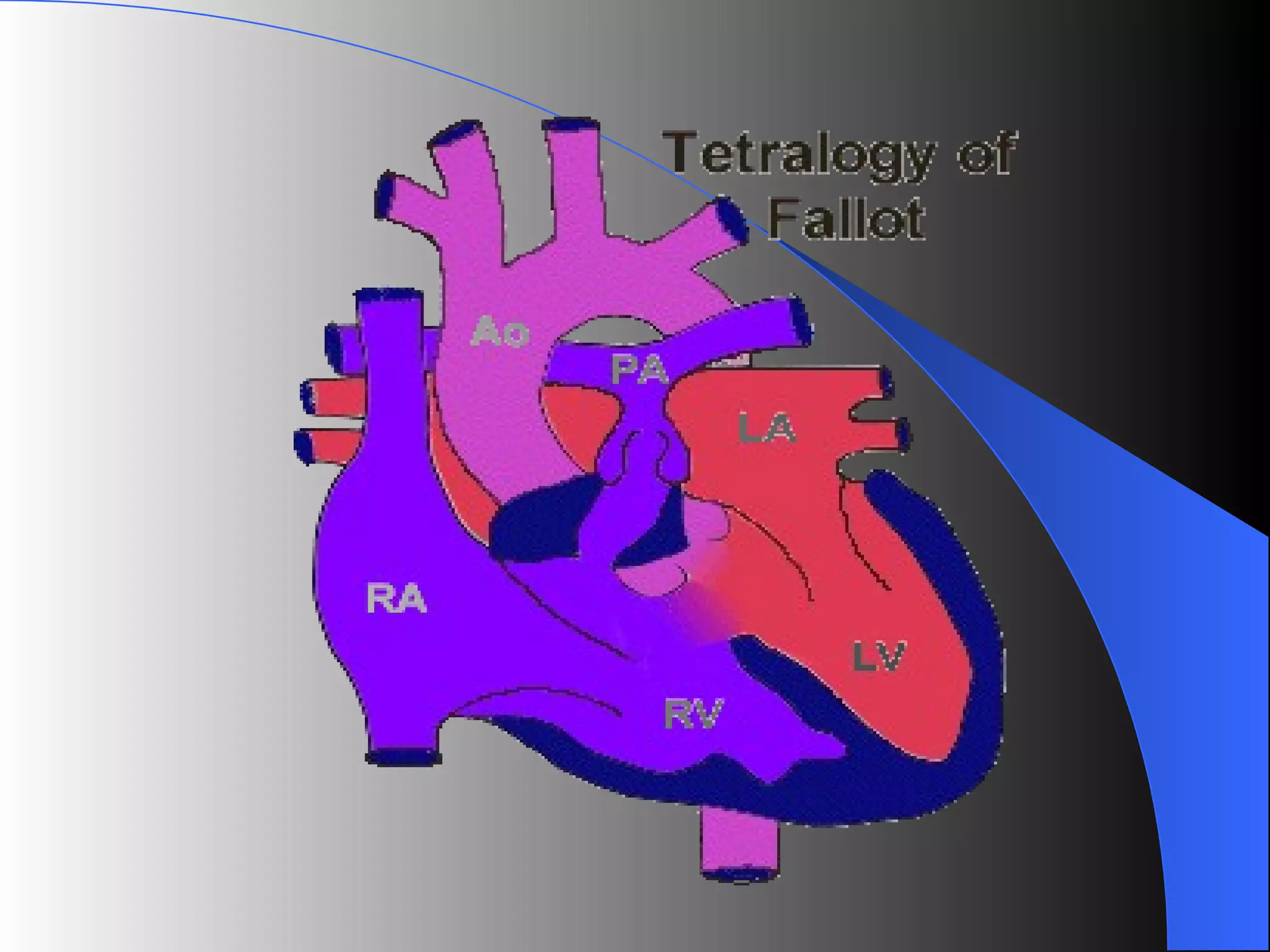 Neonatal Cardiology | PPT