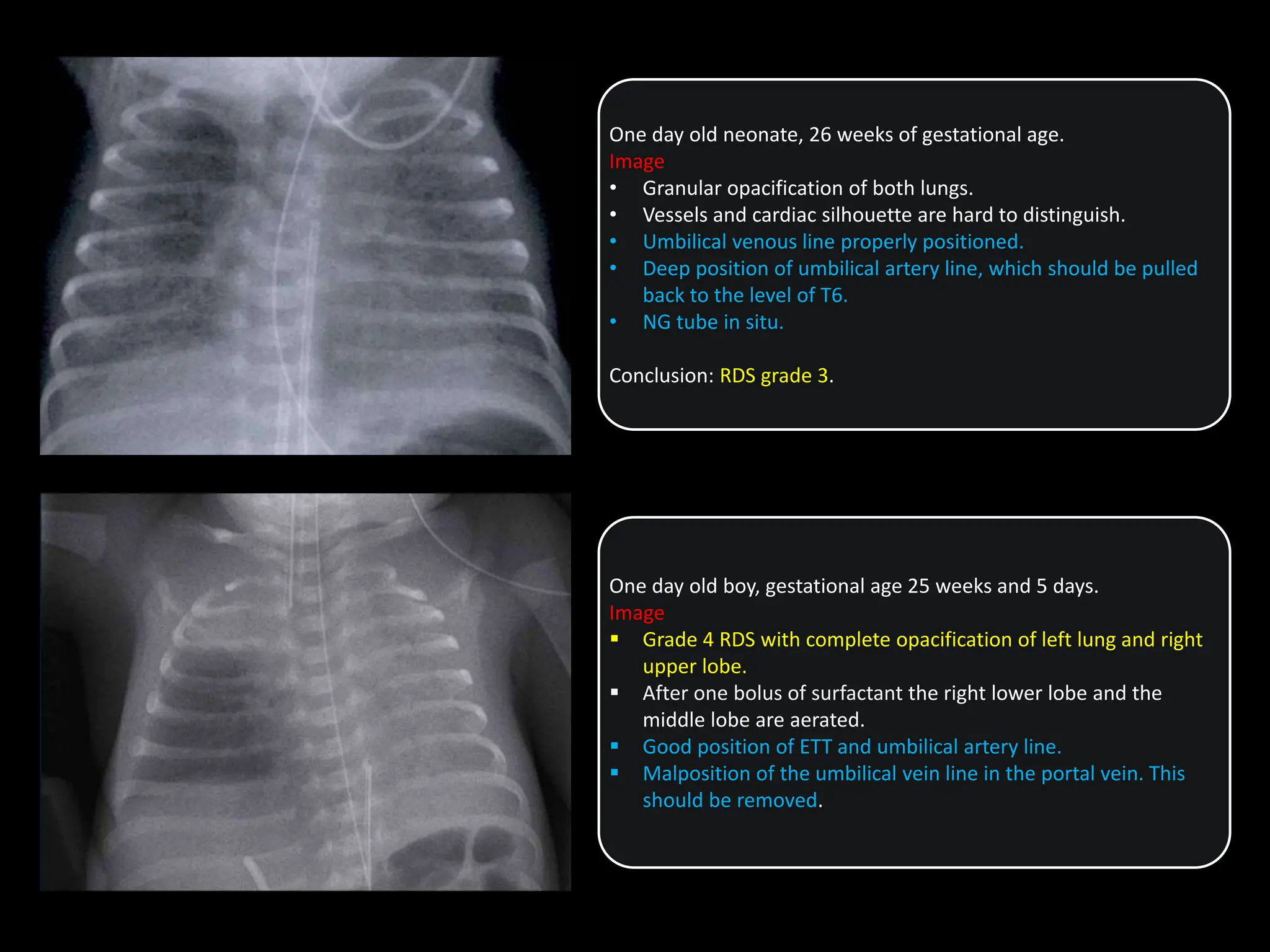 The Neonatal chest dr.xay.pptx