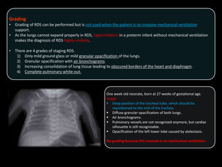 The Neonatal chest dr.xay.pptx
