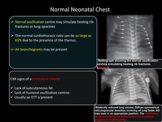 The Neonatal chest dr.xay.pptx