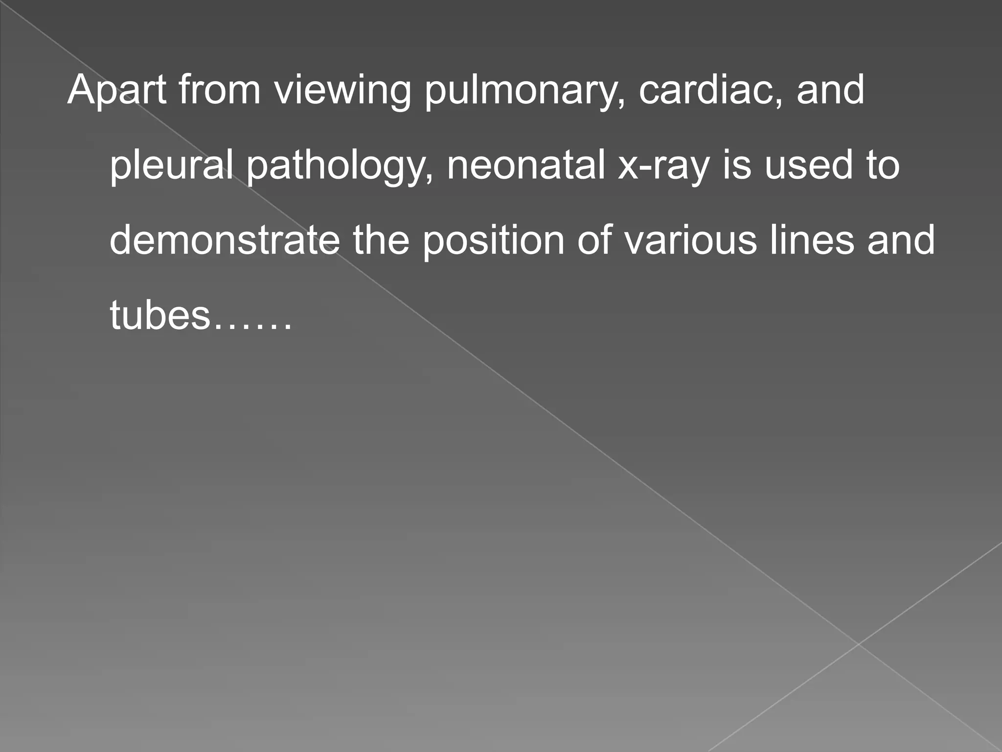 Neonatal chest x ray reading | PPTX