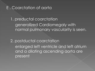 Neonatal chest x ray reading | PPT